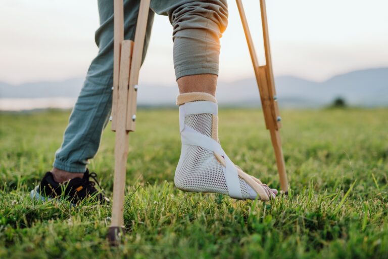 Foot and Ankle Fractures - How Can a Podiatrist Help?