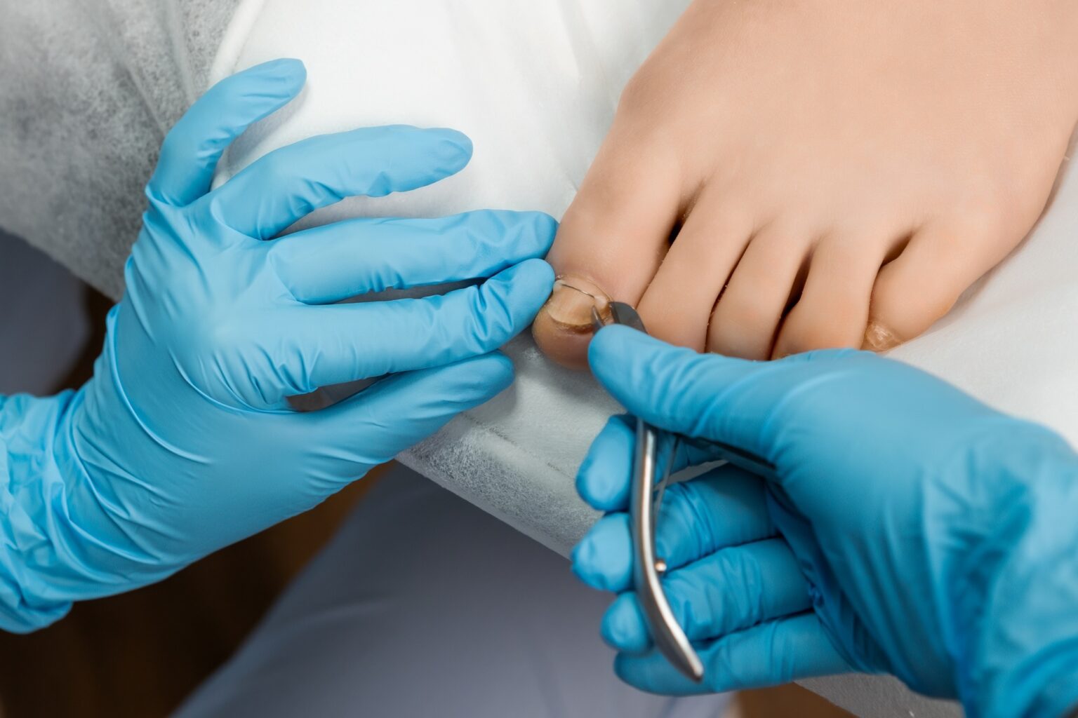 Ingrown Toenail - Is it Time To See a Podiatrist?