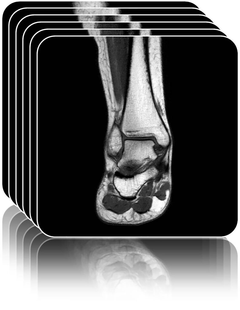 Foot & Ankle MRI in IL, IN, WI | Weil Foot & Ankle Institute