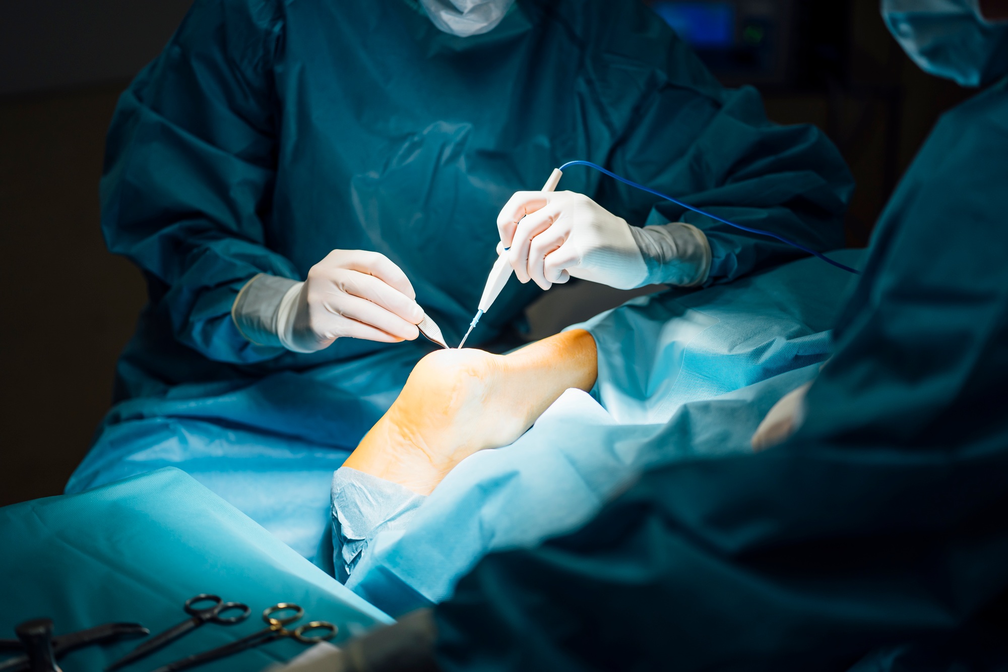 Foot and Ankle Surgery - Our Experts Can Help!